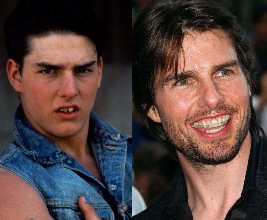 Here's What We Know About Tom Cruise And His Strange Teeth