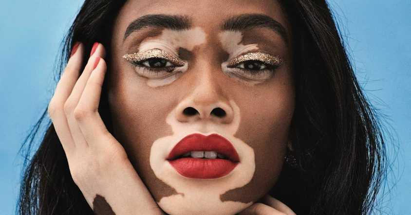 What Happened To America's Next Top Model's Only Deaf Contestant After ...