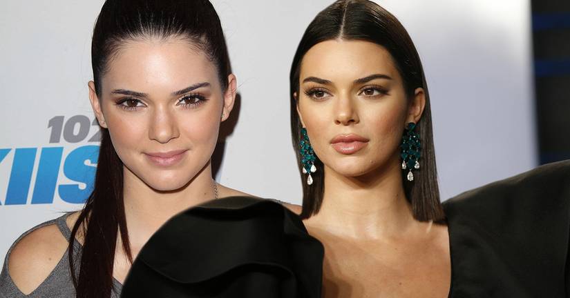 Kendall Jenner Is Notorious For Photoshop Fails, Here Are Her Worst ...