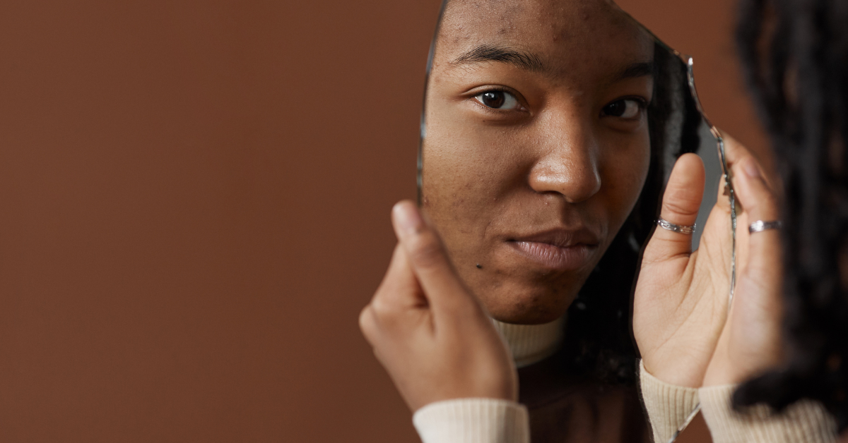 The Truth About Cystic Acne, What Work's And What Doesn't