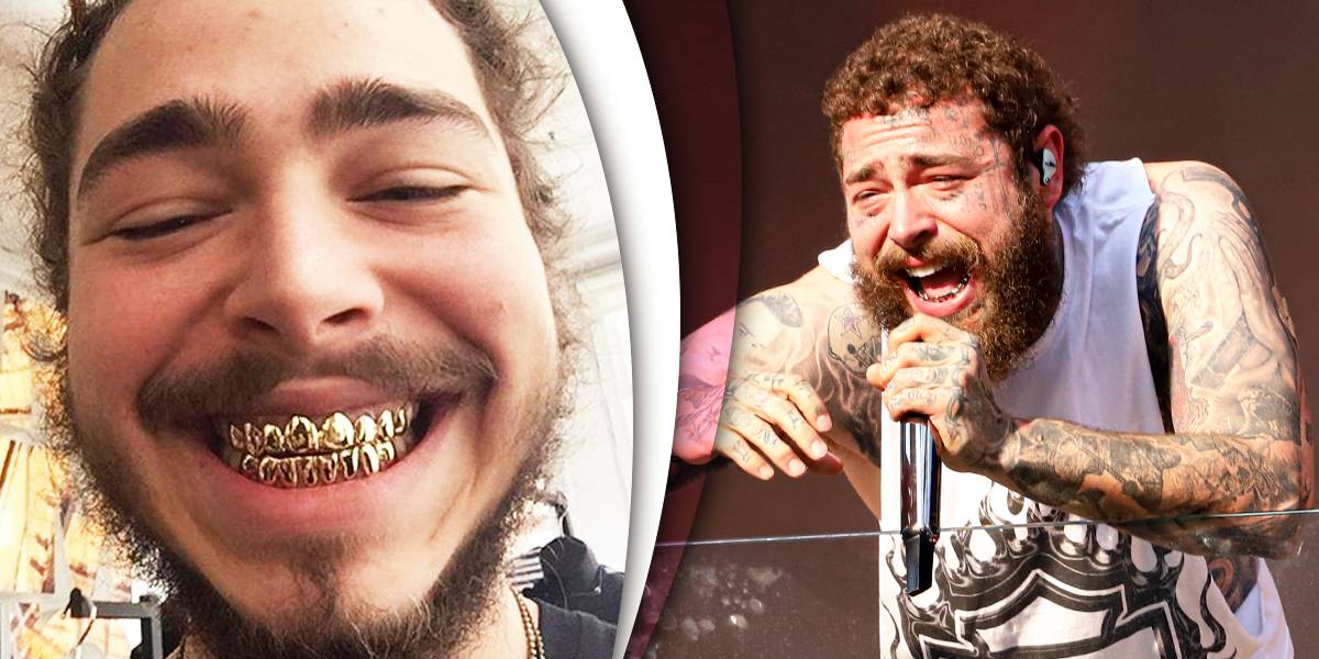 Here's Why Fans Are Curious About Post Malone's Teeth