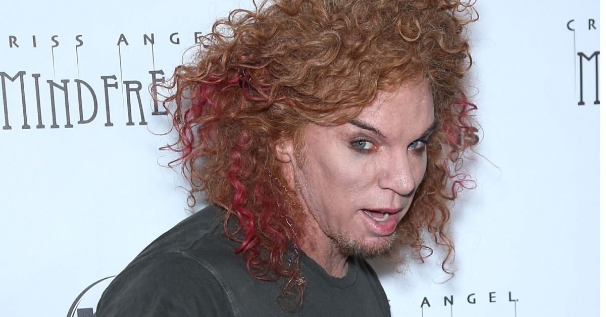 Carrot Top Plastic Surgery