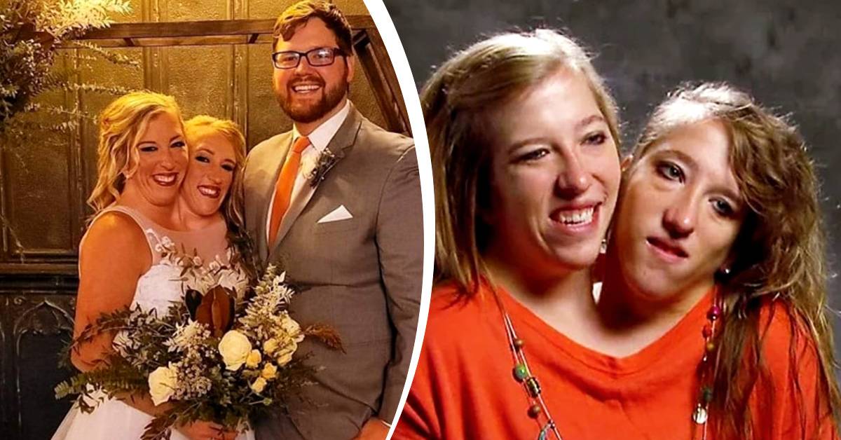 Now That Conjoined Twin Abby Hensel Is Married, What Is Brittany Hensel ...